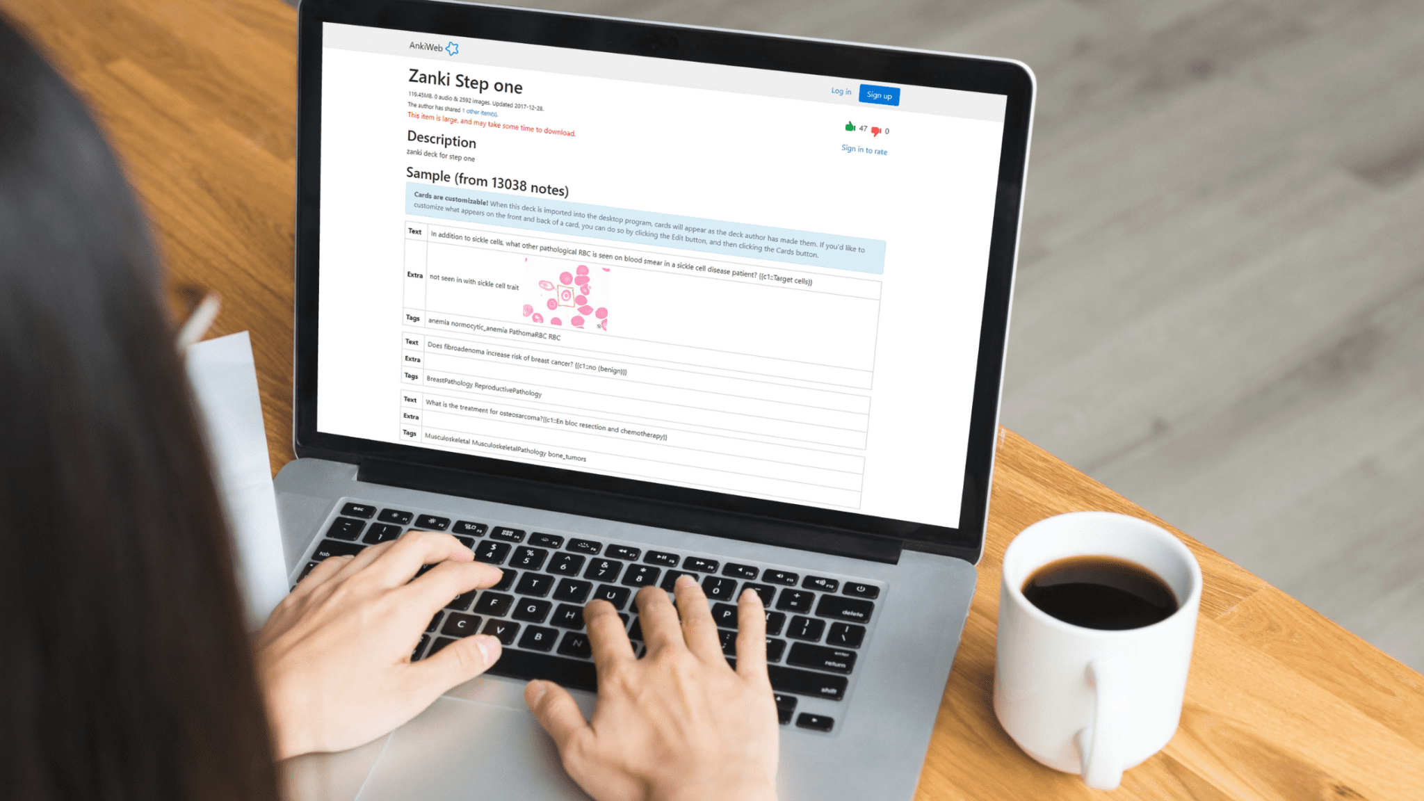 Zanki: USMLE Flashcard Resource Reviews | Elite Medical Prep